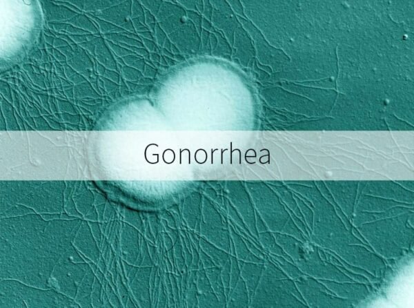 Gonorrhea Treatment Archives - Ghanamedicals.com